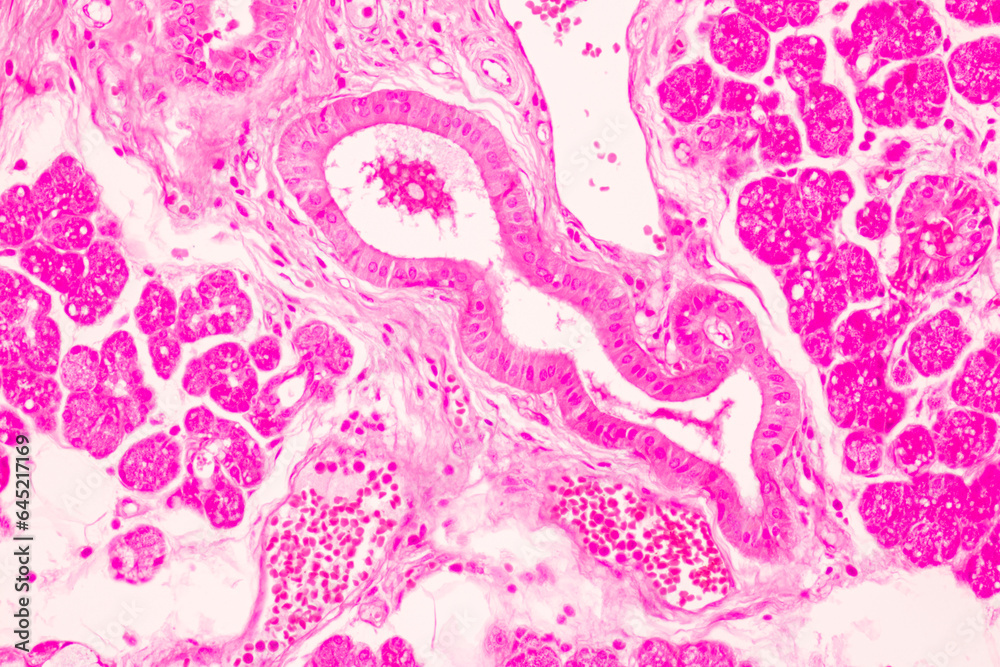 Anatomy and Histological Tonsil and Parotid Human cells under ...
