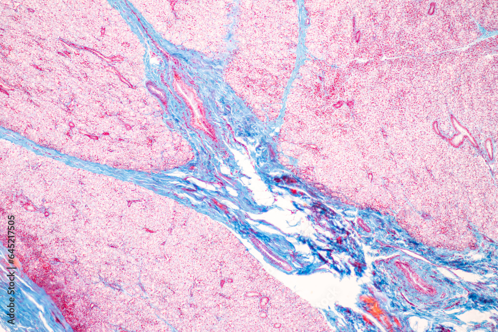 Anatomy and Histological Tonsil and Parotid Human cells under ...