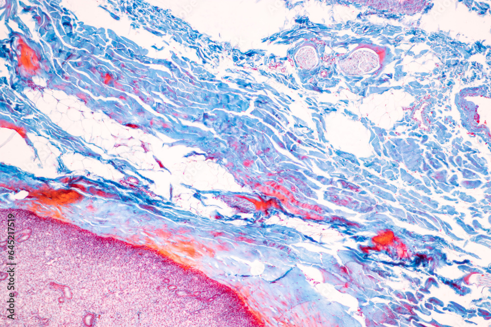 Anatomy and Histological Tonsil and Parotid Human cells under ...