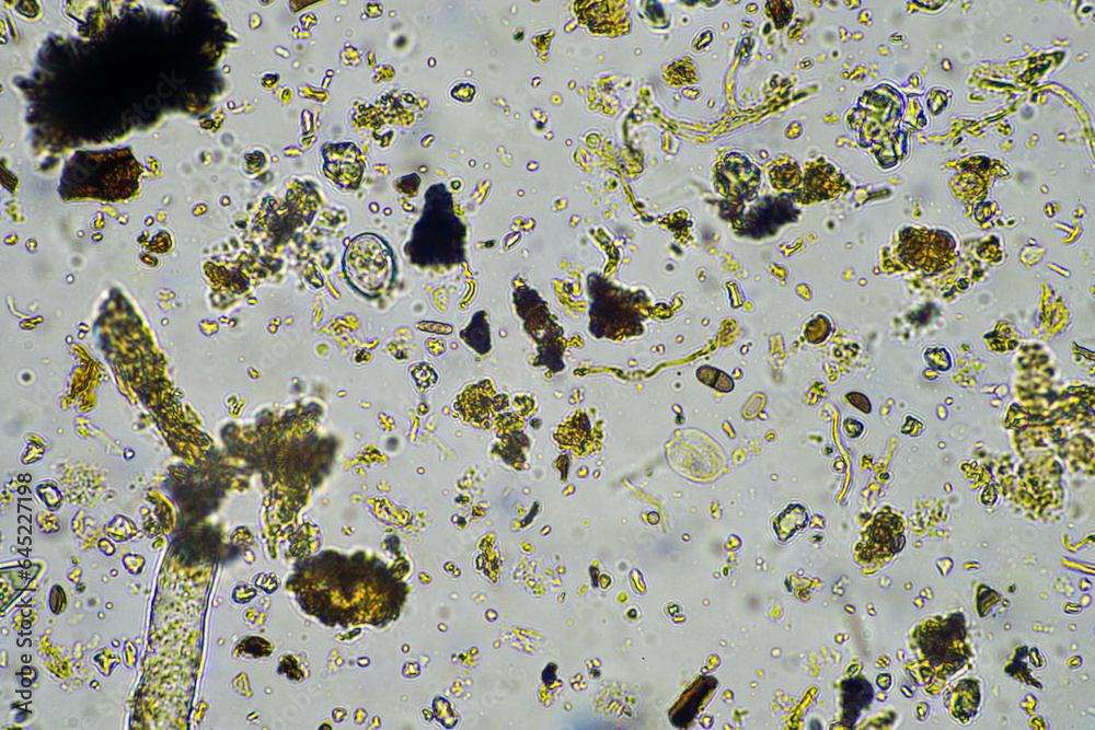 soil microorganisms close up under the microscope. in a soil samlple ...