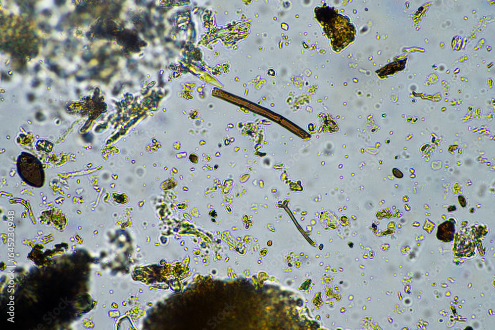 soil microorganisms close up under the microscope. in a soil samlple ...