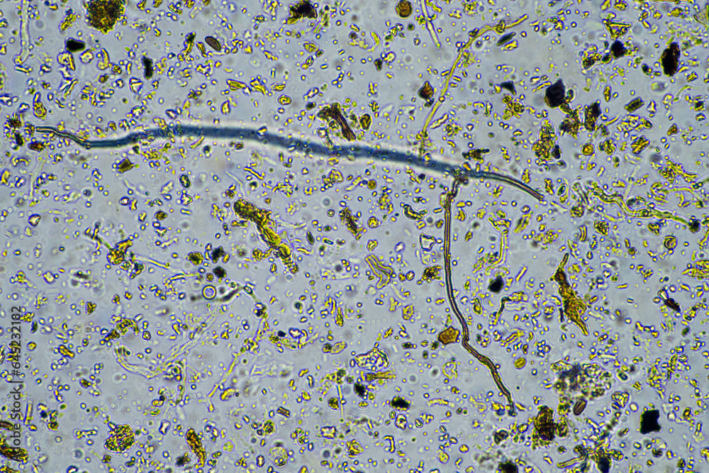 soil microorganisms close up under the microscope. in a soil samlple ...