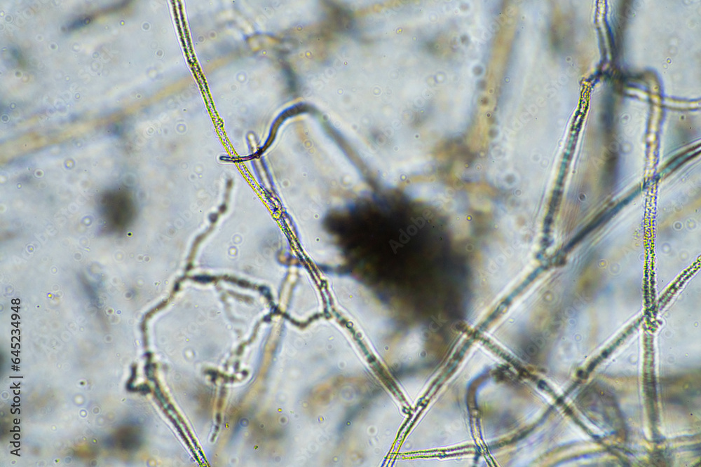 Fungal and fungi hyphae under the microscope in the soil and compost ...