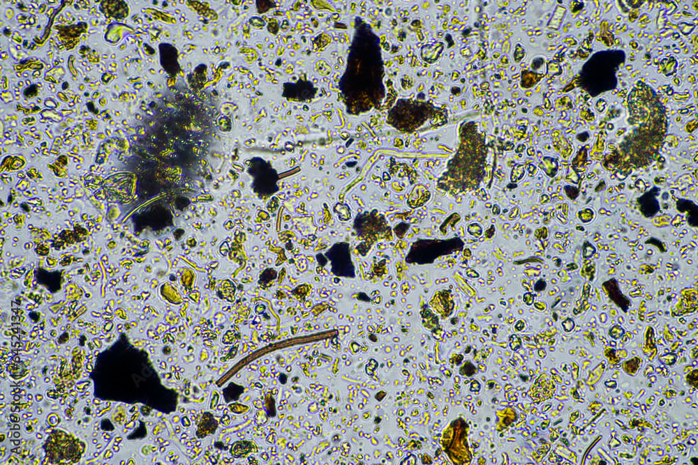 soil microorganisms close up under the microscope. in a soil samlple ...