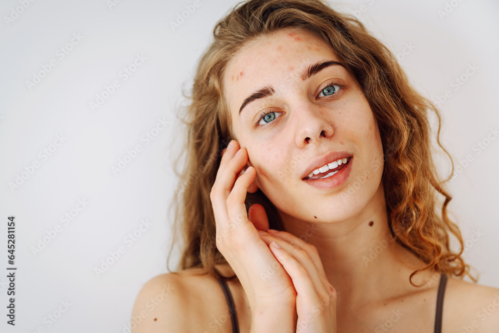 Close-up portrait of a beautiful woman without makeup with imperfect ...