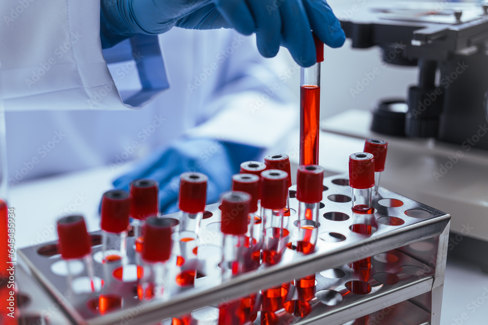 Hands of a doctor or female doctor collecting blood sample tubes from ...