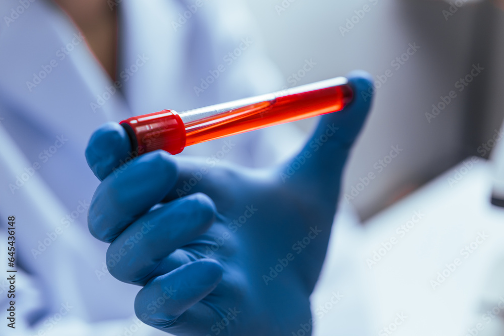 Hands of a doctor or female doctor collecting blood sample tubes from ...