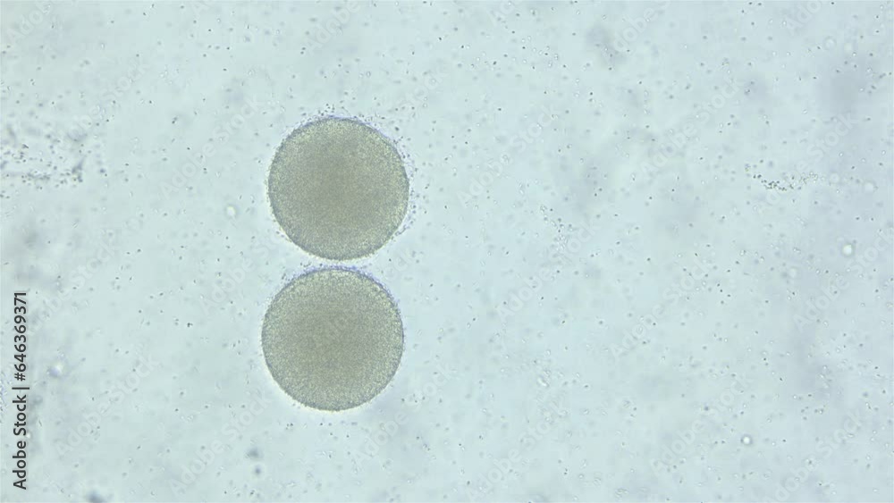 Sperm and ovule sea urchin Strongylocentrotus pallidus under microscope ...