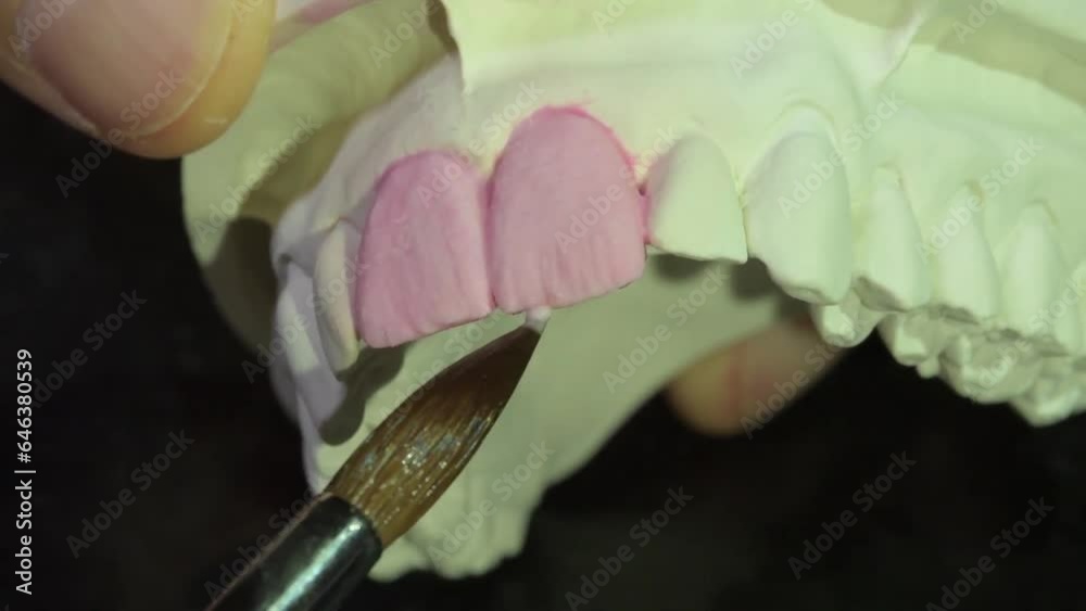 close up of precise Ceramic crown layering process, dental laboratory ...