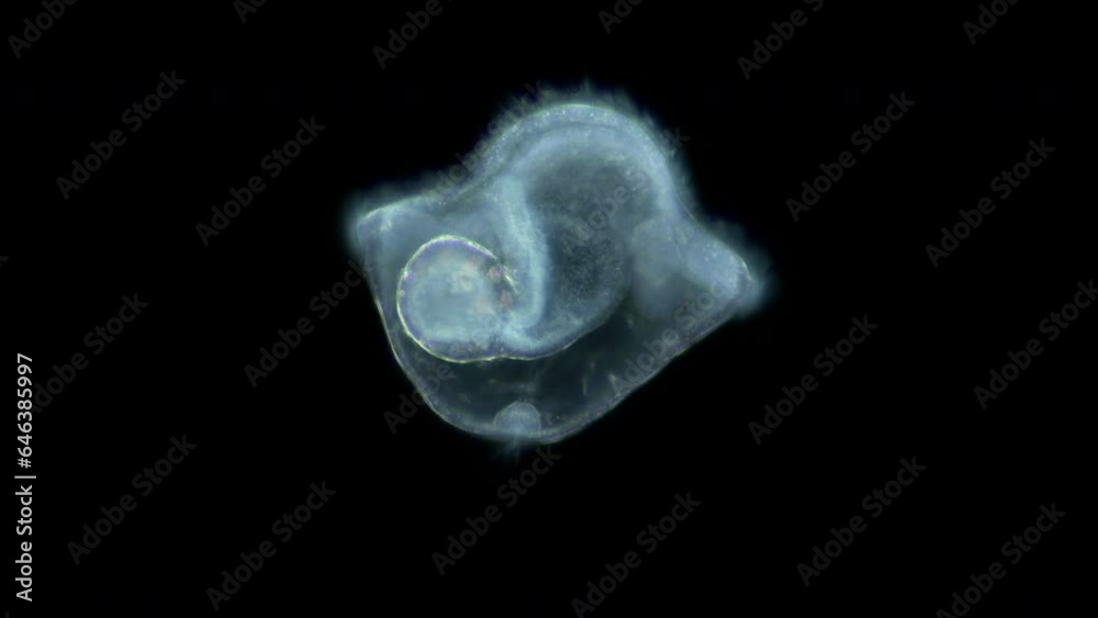 Pilidium larva of worm Heteronemertea under microscope, genus ...