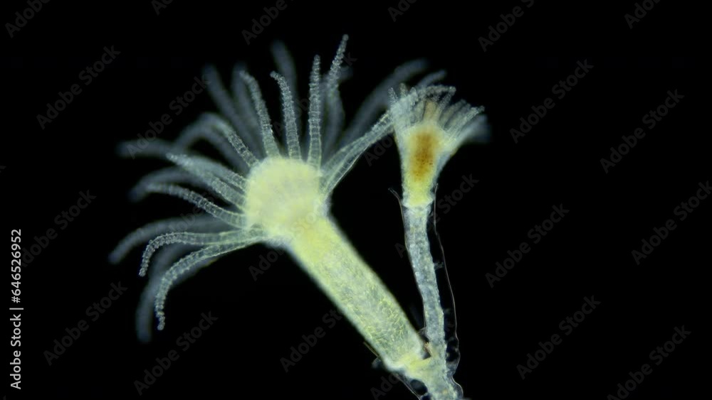 Hydrozoa polyp of Leptothecata order under microscope, possibly genus ...