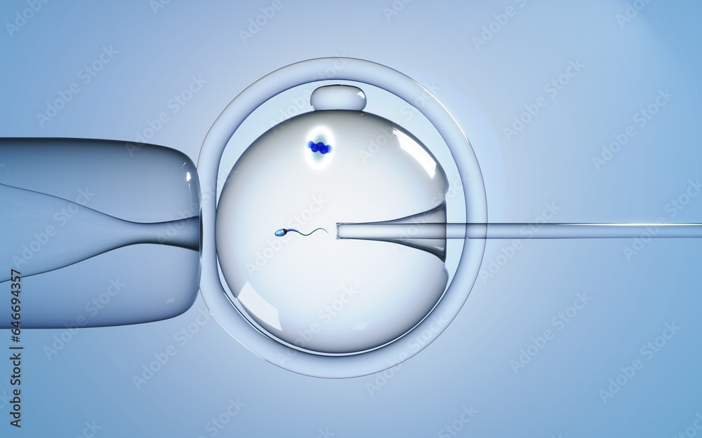 In vitro fertilization. Sperm injection using the piezo device. The ...