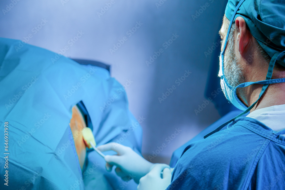 Surgical doctor cleaning with anti septic in back of patient preparing ...