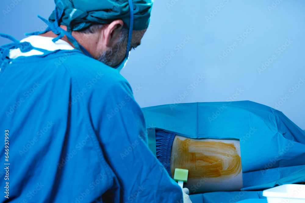 Surgical doctor cleaning with anti septic in back of patient preparing ...