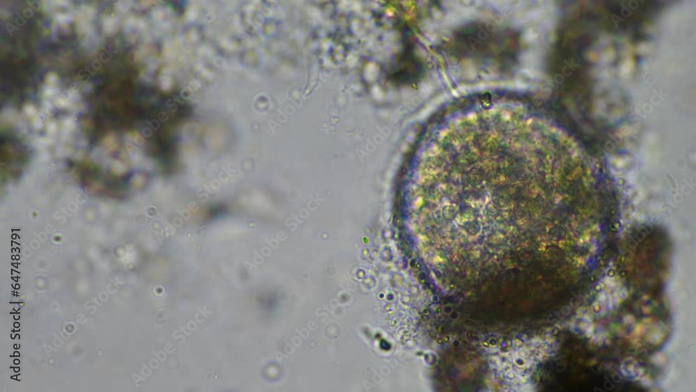 soil microorganisms close up under the microscope. in a soil samlple ...