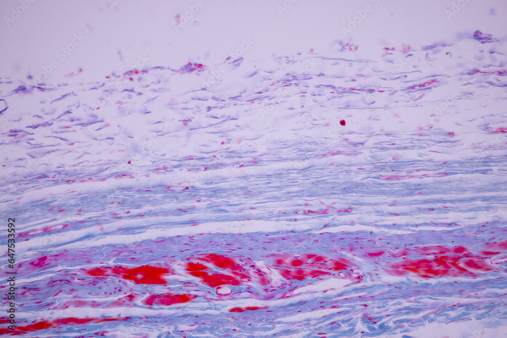 Backgrounds of Characteristics Tissue of Human scalp, Skin human from ...