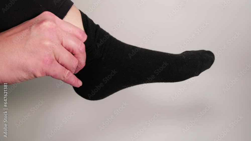 Painful inflammations on female foot after several confluent blisters ...