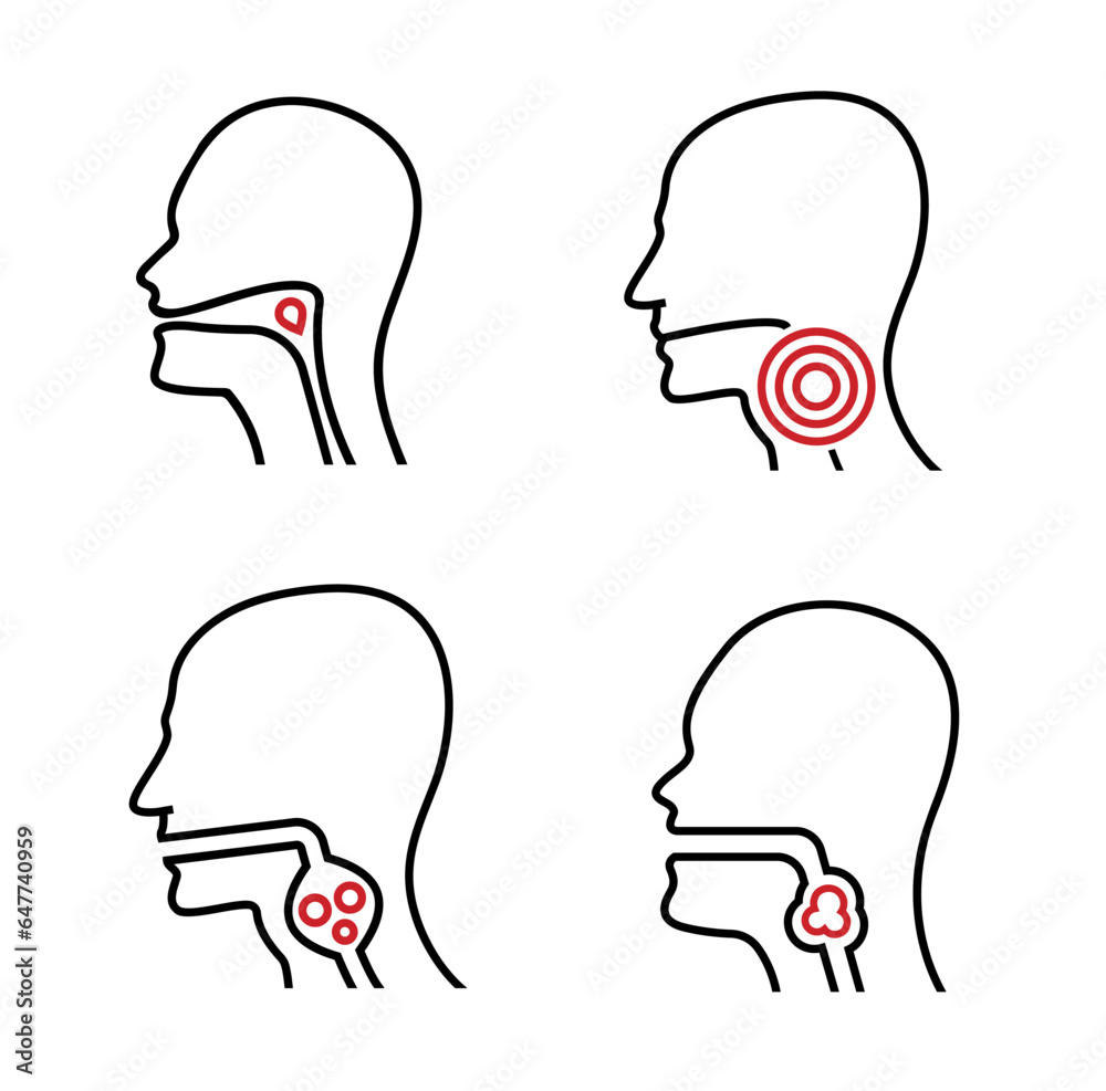 Dysphagia linear icon. Aphagia line pictogram. Difficulty in swallowing ...