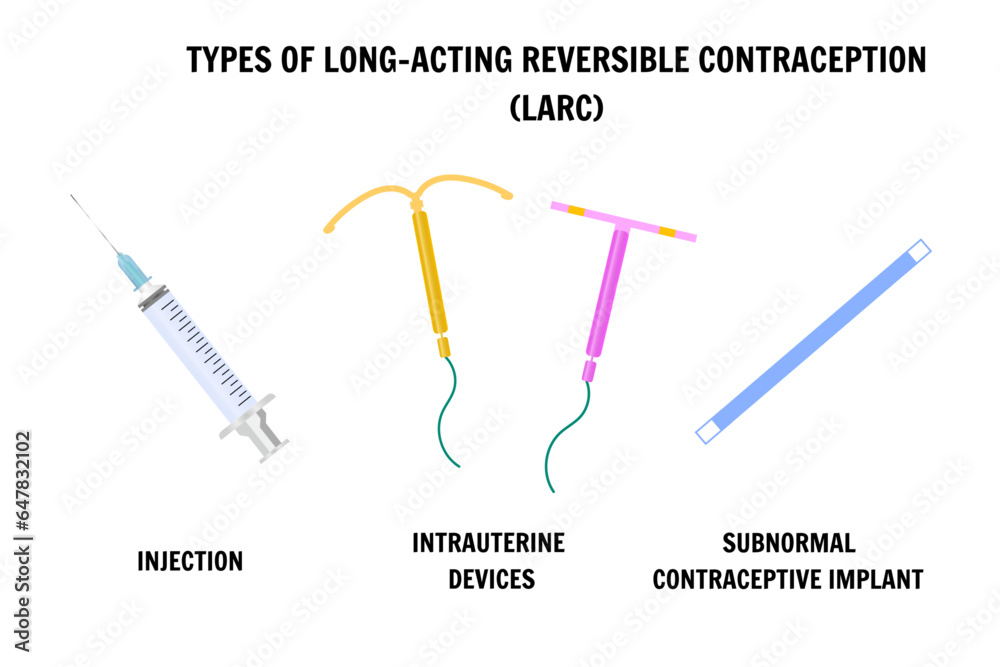 Types of long-acting reversible contraception LARC Stock Vector | Adobe ...