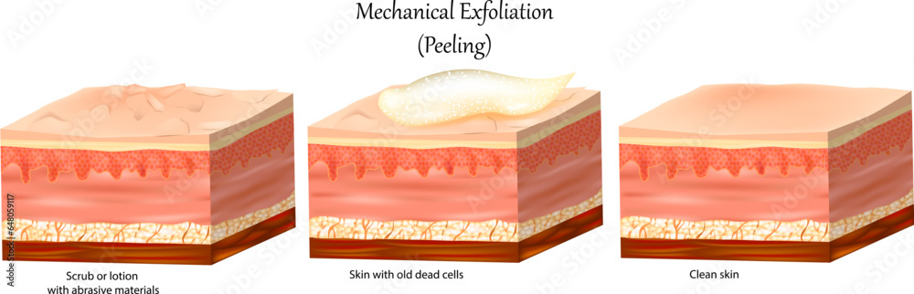 Mechanical Exfoliation or Peeling. Skin care with Face and Body. Cross ...