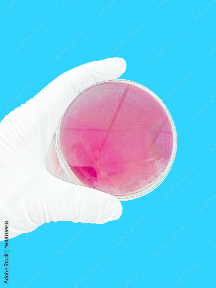Doctor's bacterial culture and bacterial culture media to test for ...