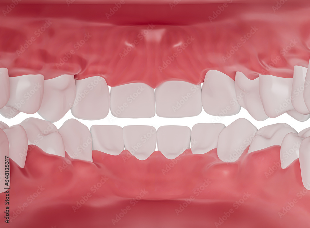 Realistic dental arch in on transparent background in 3d render Stock ...