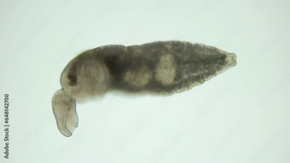 Parasitic worm Podocotyle sp. in marita stage under microscope, family ...