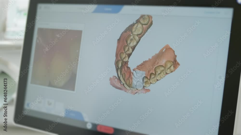 Doctor scans the patient's teeth in the clinic. The dentist holds in ...