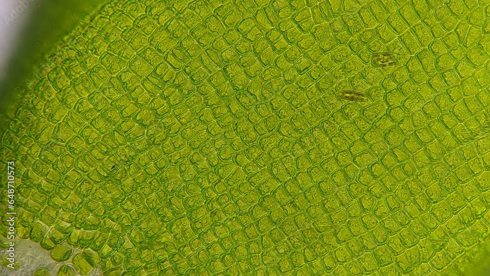 Ulva compressa cells at 840x magnification. Some diatom is attached to ...