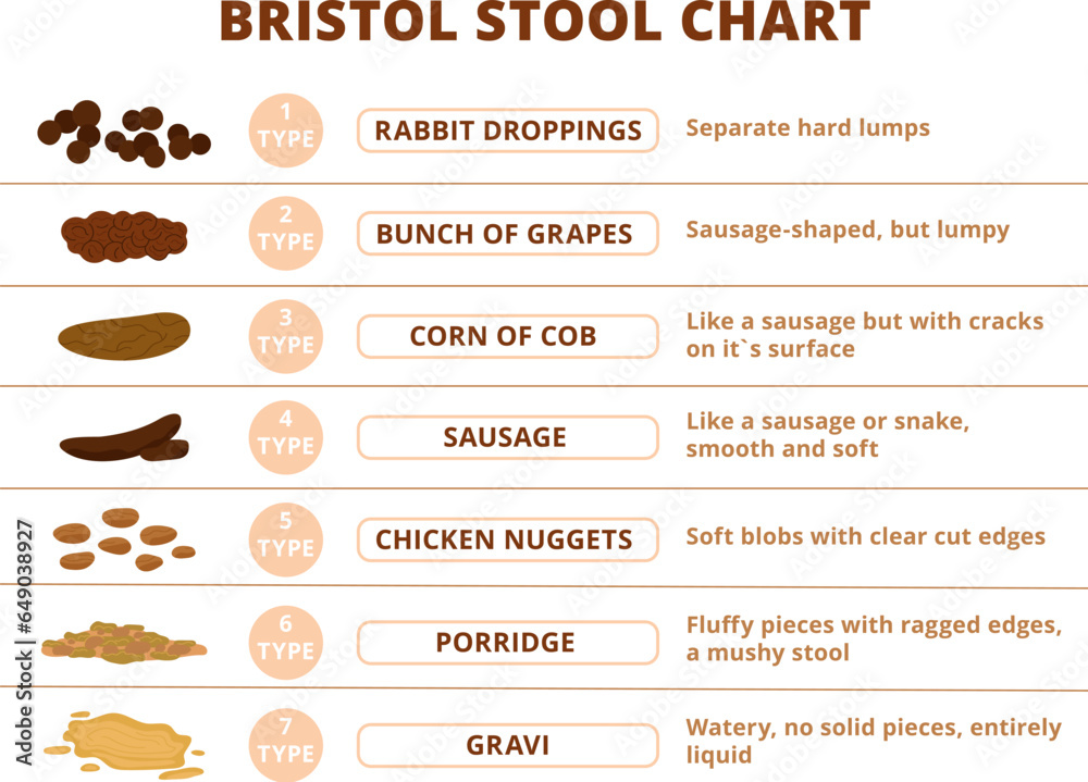 Bristol stool scale, poop types infographic. Digestive problems medical ...