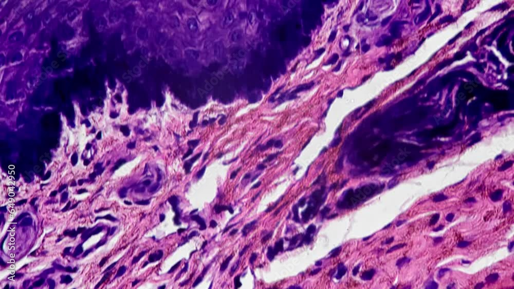 A microscopic view of a cross sectional view of the human penis under ...