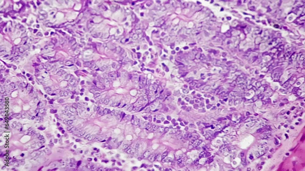 Vidéo Stock Section of human large intestine magnified under microscope ...