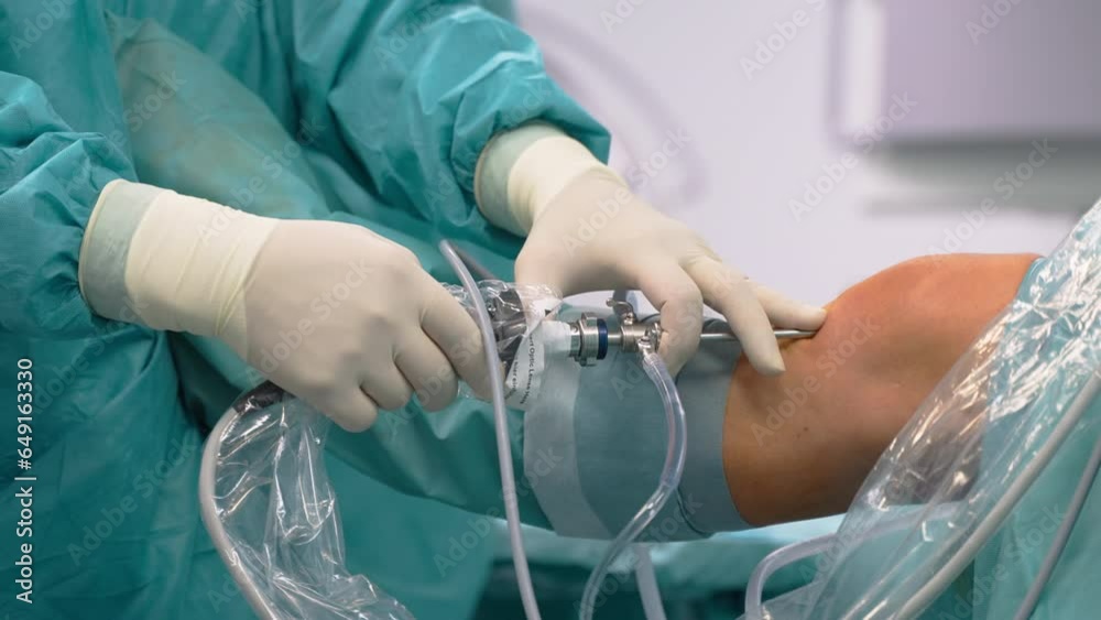 Surgeon Performing Knee Arthroscopy Operation in Hospital With Viewing ...
