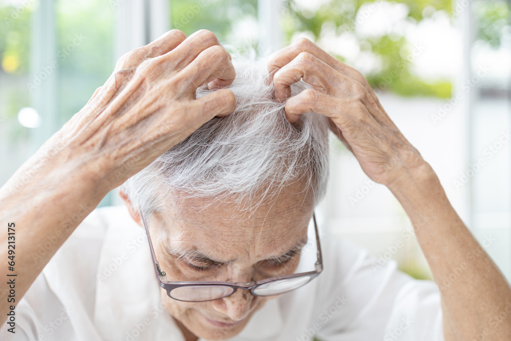 Senior woman scratching her head,itchy scalp and hair loss,allergic ...