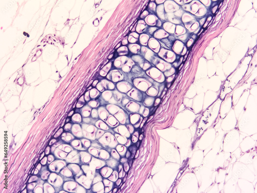 picture of histology human tissue with microscope from laboratory (not ...