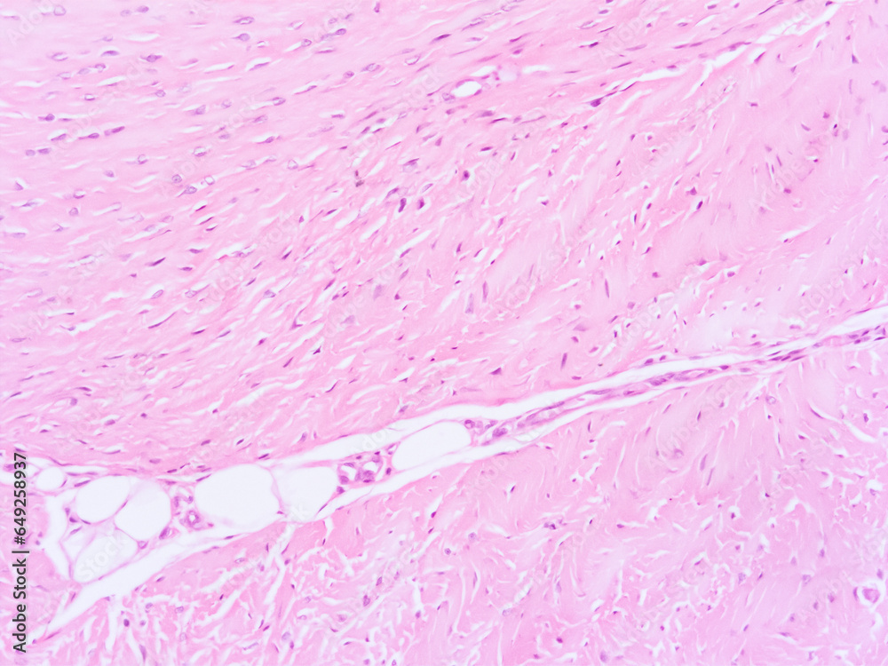 picture of histology human tissue with microscope from laboratory (not ...