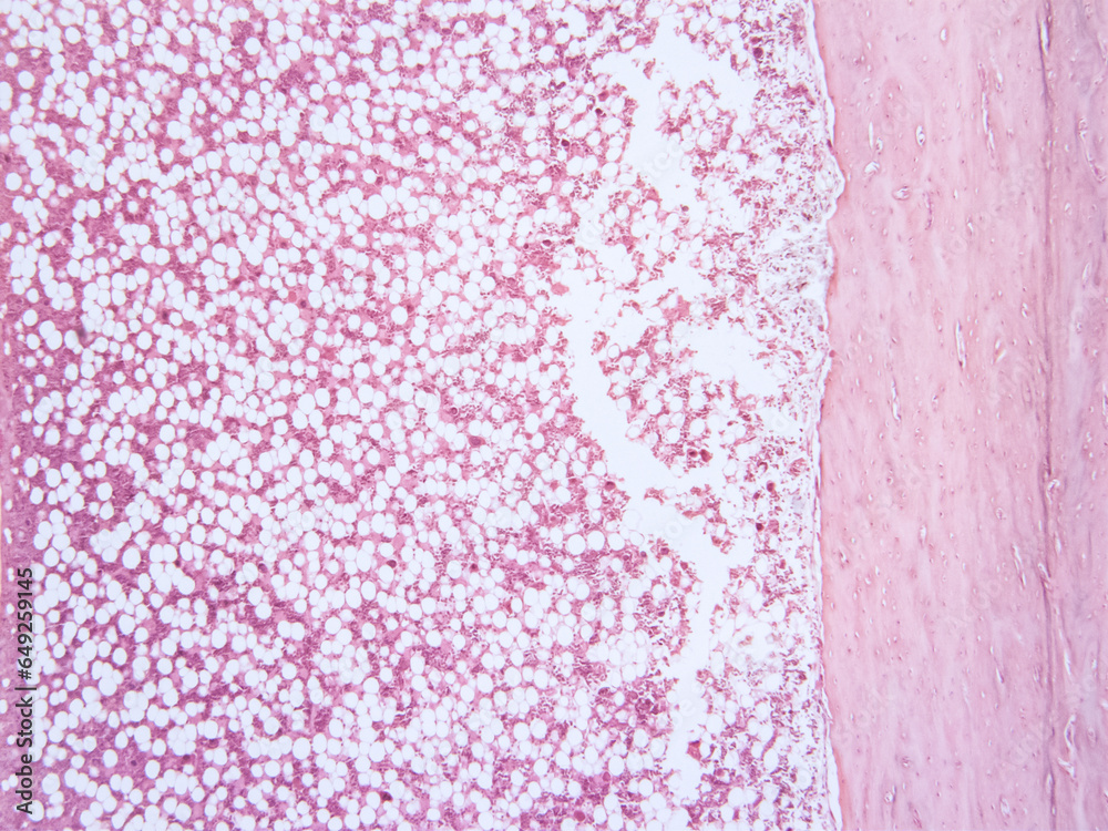 picture of histology human tissue with microscope from laboratory (not ...