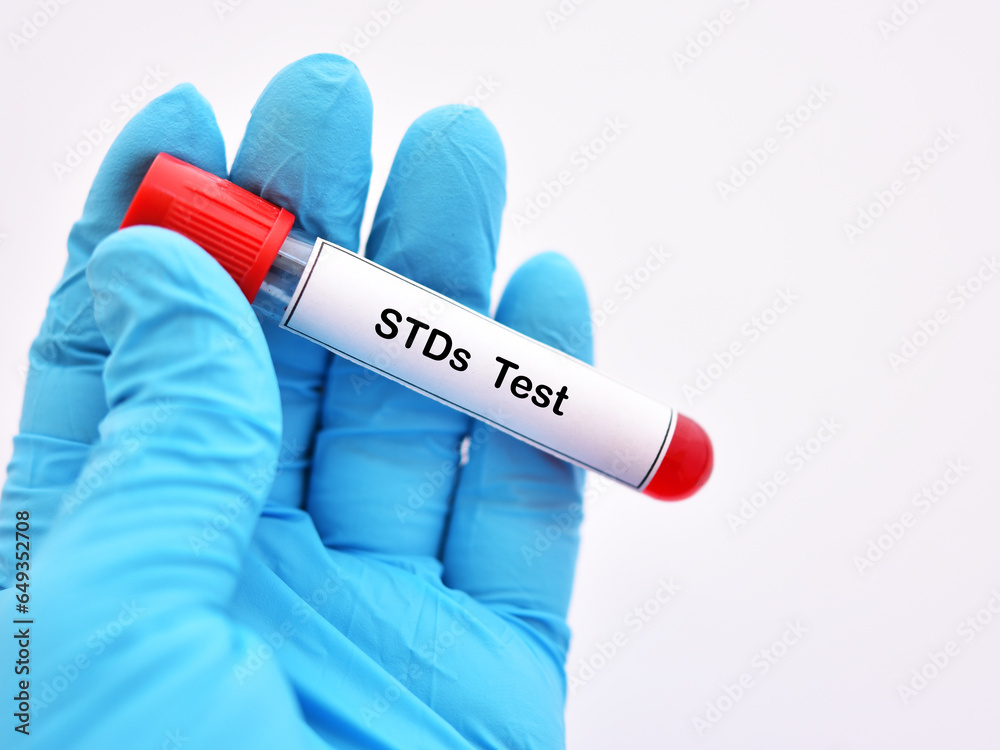Blood sample tube for STDs (sexually transmitted diseases) test Stock ...