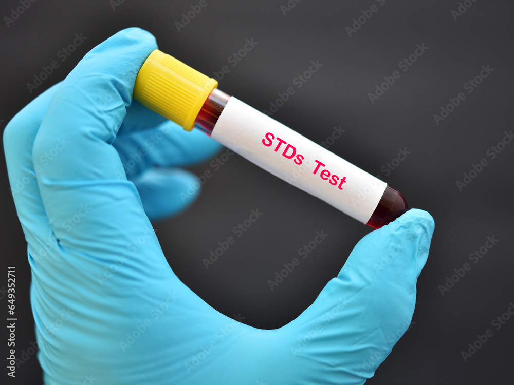 Blood sample tube for STDs (sexually transmitted diseases) test Stock ...