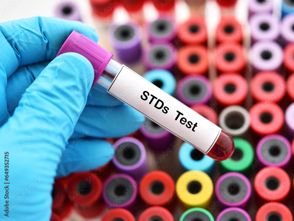 Blood sample tube for STDs (sexually transmitted diseases) test Stock ...