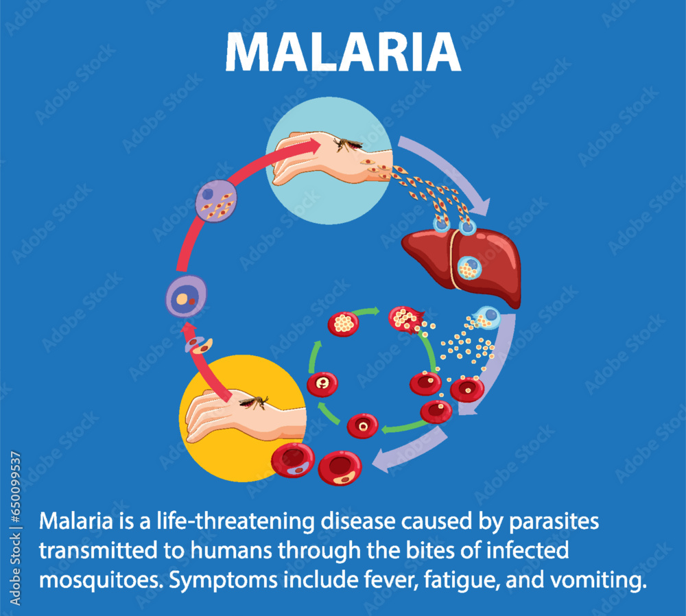 Life Cycle of Malaria Parasite: A Visual Guide Stock Vector | Adobe Stock