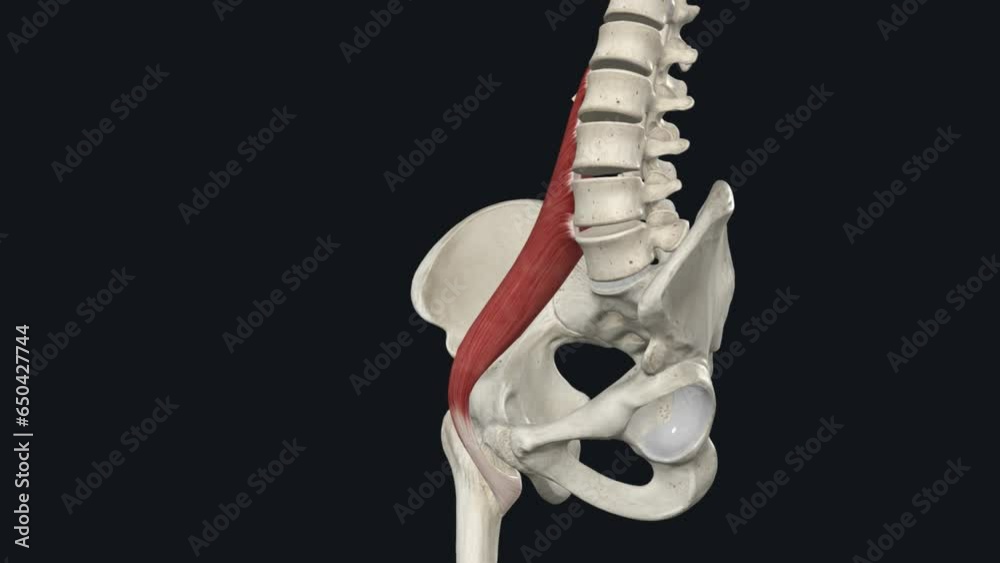 The psoas muscle is a paraspinal muscle located deep in the body, very ...