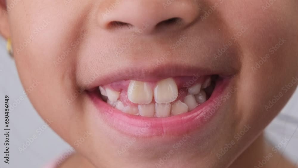 Close-up of cute young girl smiling wide, showing empty space with ...