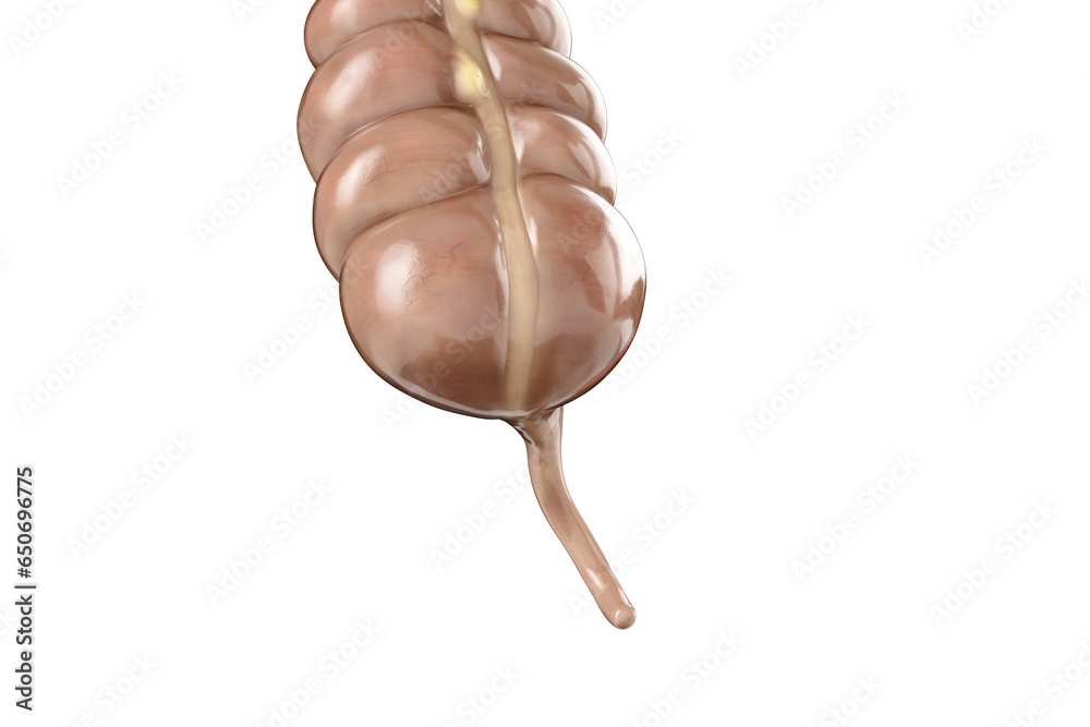 3d illustration of human appendix anatomy. High quality realistic ...