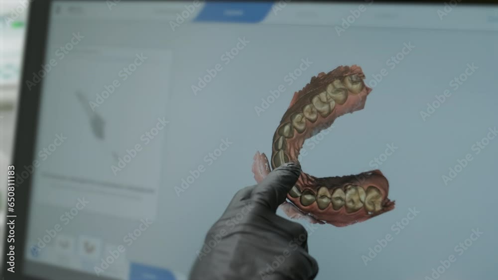 Doctor scans the patient's teeth in the clinic. The dentist holds in ...