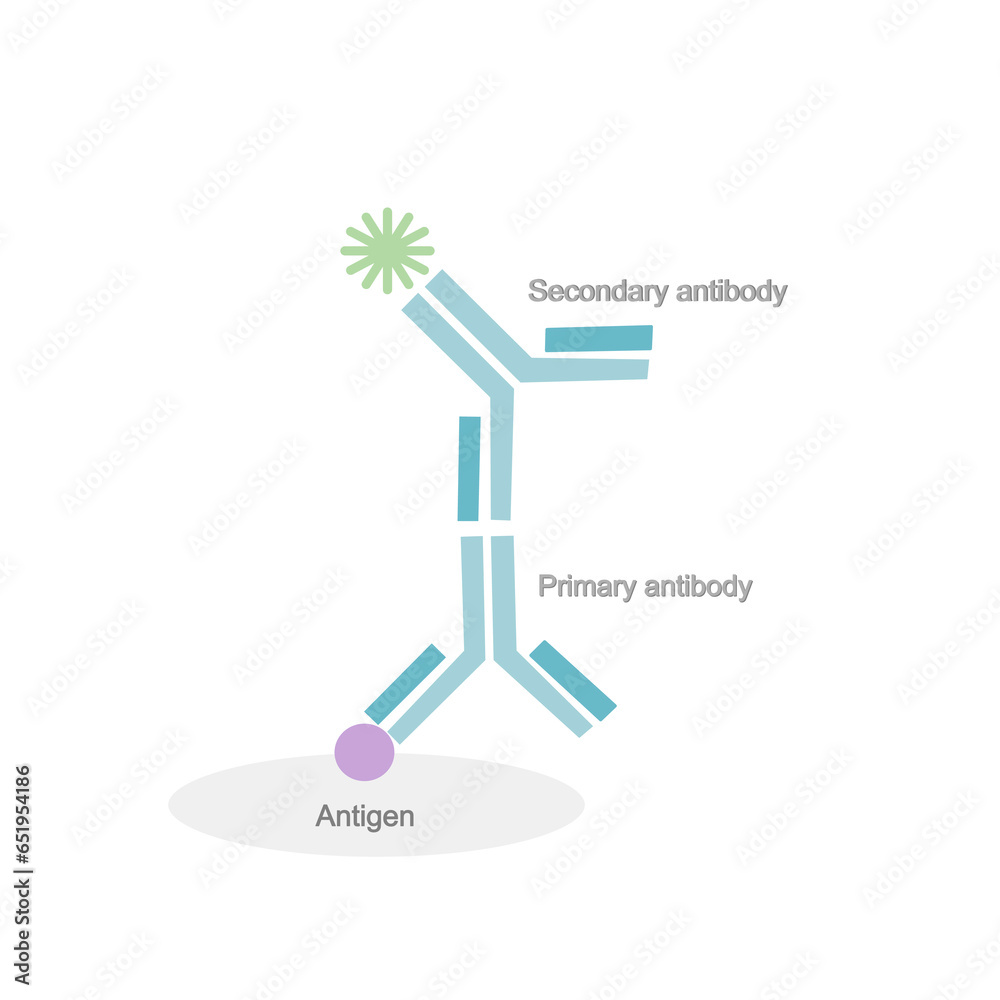 The picture shows the principle of ELISA technique: the primary ...