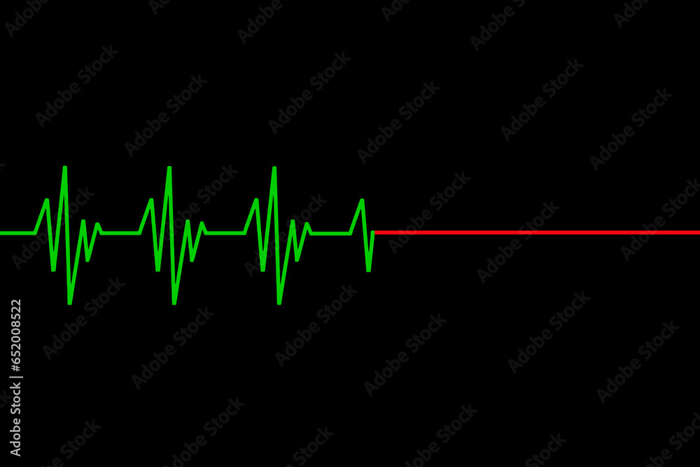 Cardiac cardiogram pulse diagram at death, cardiac arrest on the ...