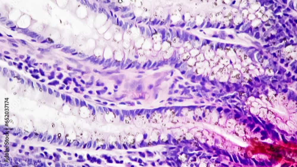 Vidéo Stock Human rectum tissue magnified under microscope in 400 times ...