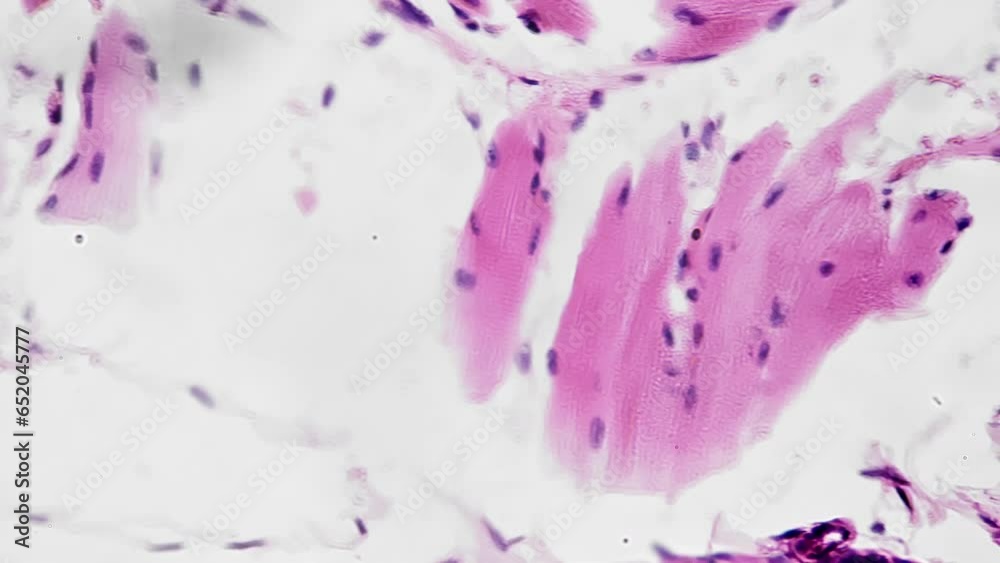 Pattern of human tongue in section showing filiform papillae under ...