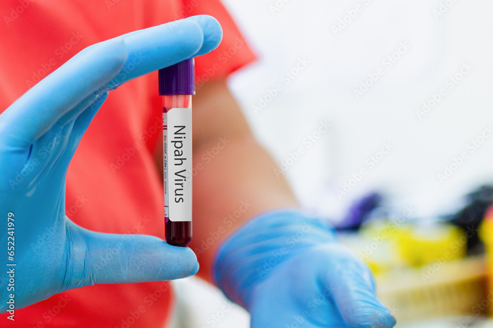 Nipah virus concept.Womans hand holding a glass test tube.Nipah ...